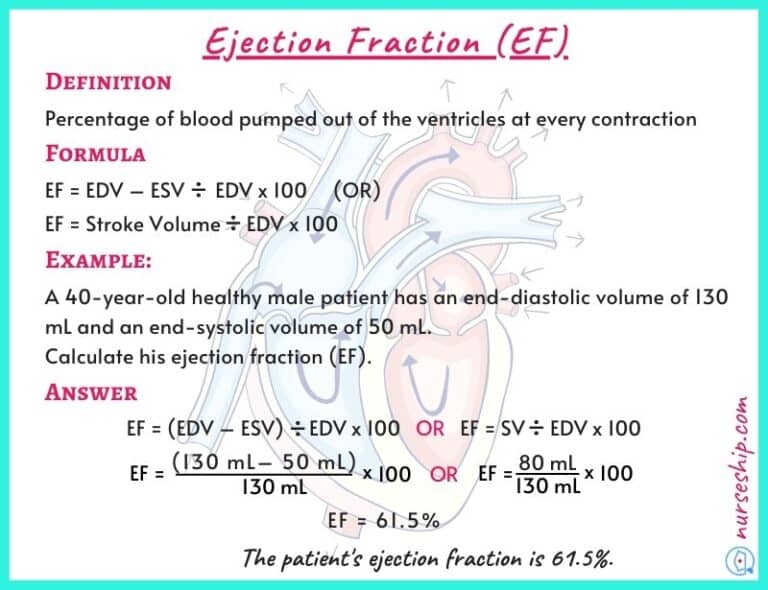 Cardiac Preload Vs Afterload Vs Contractility With An Example Nurseship