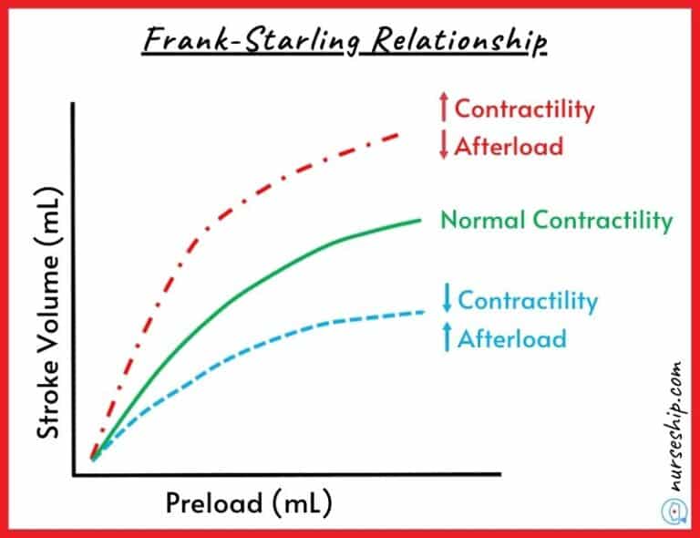 Cardiac Preload Vs Afterload Vs Contractility With An Example